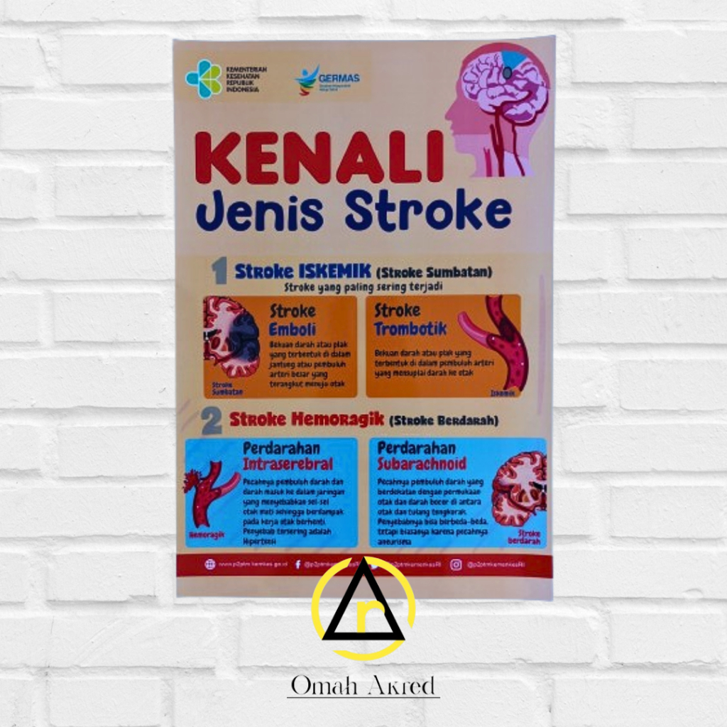 Jual Poster Kenali Jenis Stroke - Lansia PTM - Penyakit - Poster ...