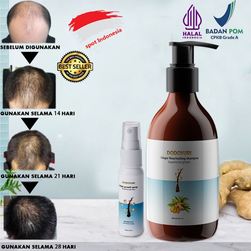 Jual Shampoo rambut rontok sampo penumbuh rambut cepat sampo anti ketombe dan rontok penumbuh ...