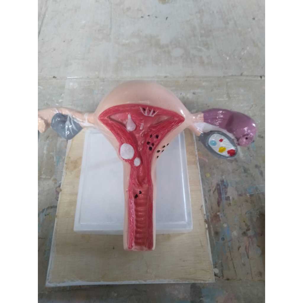 Jual Manikin Uterus Ovary Anatomical Model Anatomy Uterus |Alat Peraga ...