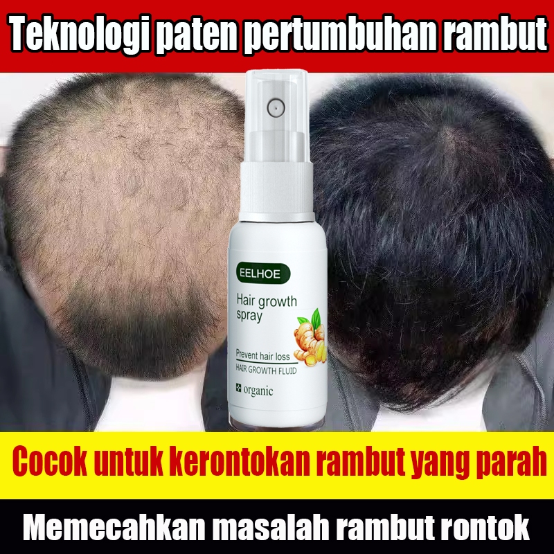 Jual Obat penumbuh rambut Hair growth serum Minyak Spray Penumbuh ...