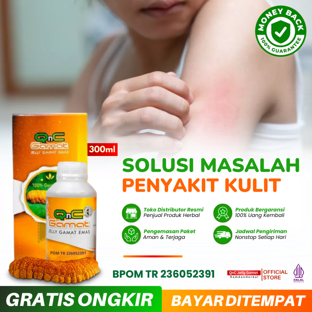 Jual Obat Gatel2 Kulit Selangkangan Pantat Infeksi Jamur Ruam Eksim QnC ...