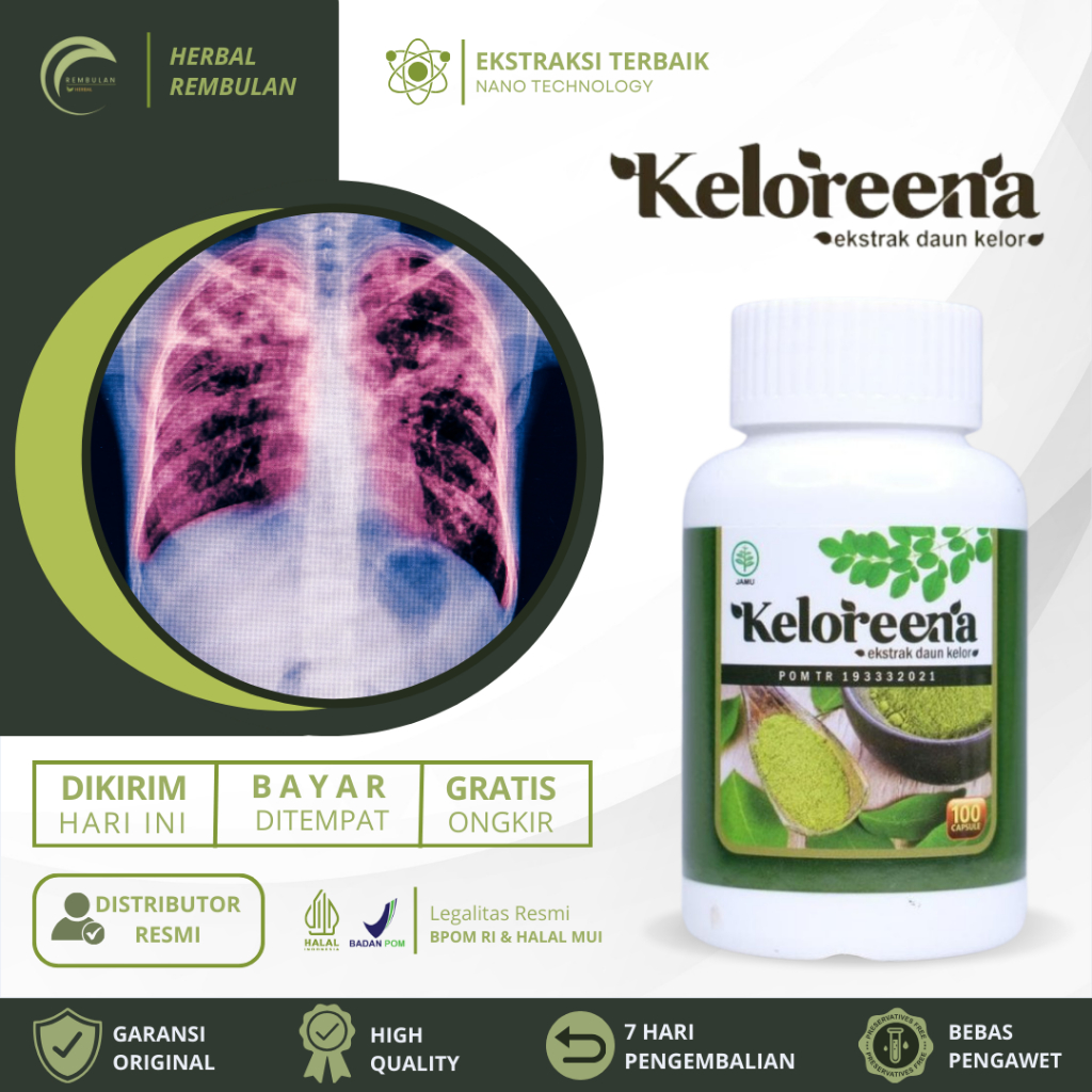 Jual Obat Radang Paru Paru Basah, Obat Pneumonia, Obat Infeksi Paru ...