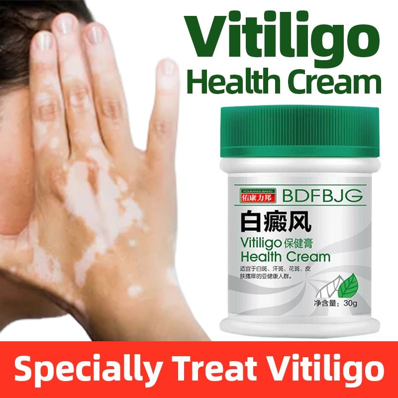 Jual 【COD ORI】Salep Vitiligo / Obat Vitiligo Paling Ampuh / Salep ...