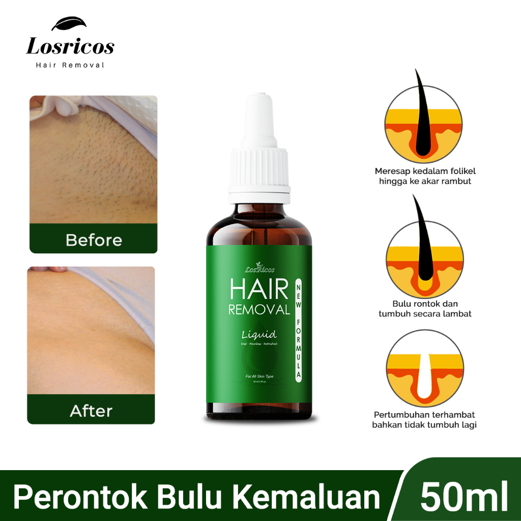 Jual Perontok Bulu Kemaluan Miss V Permanen Losricos Hair Removal ...