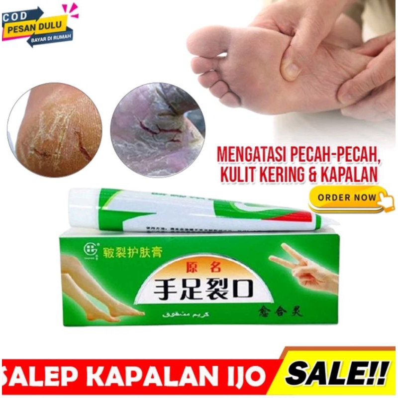 Jual Salep Tumit Pecah - Pecah / Salep Anti Kapalan / Salep Ijo ...