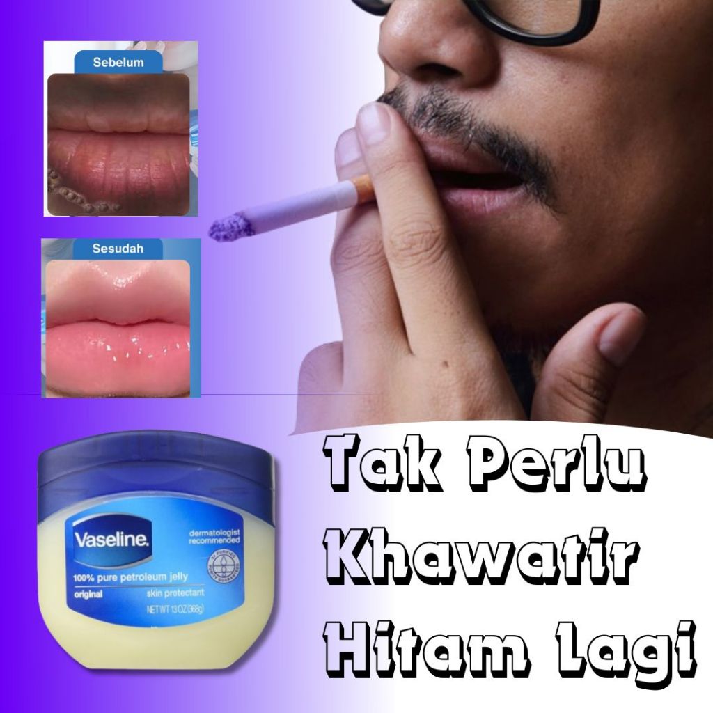 Jual Vaseline Lip Balm Original Pemerah Bibir Permanen Lipbalm Pencerah ...