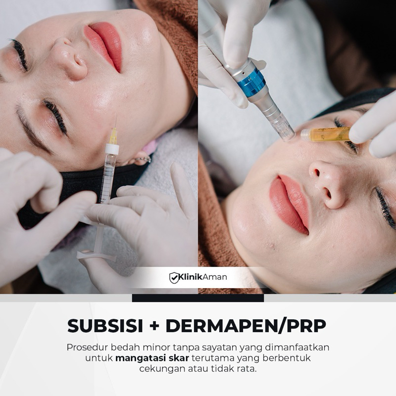 Jual SUBSISI + DERMAPEN/PRP | Shopee Indonesia