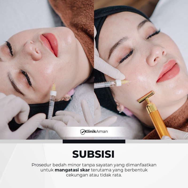 Jual SUBSISI (ACNE/SCAR) | Shopee Indonesia