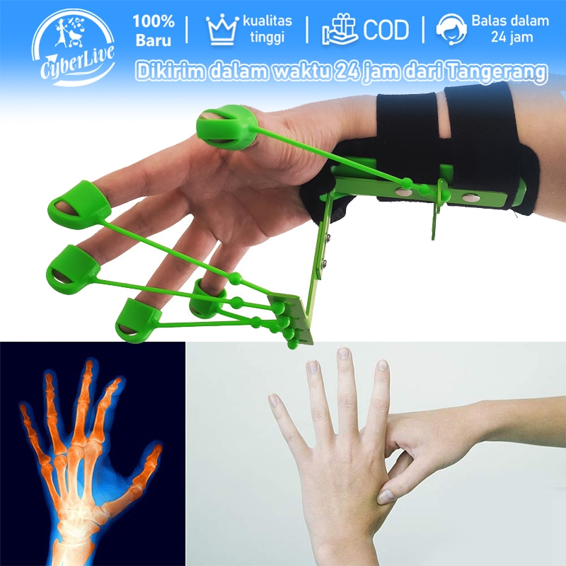 Jual Alat Terapi Tangan Untuk Terapi Stroke Tangan Finger Orthosis ...