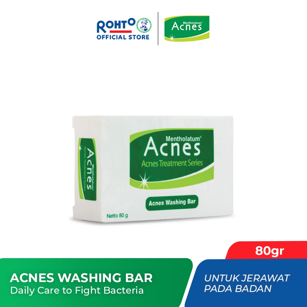 Jual Acnes Washing Bar - 80gr (Reduce & prevent redness of the skin due ...