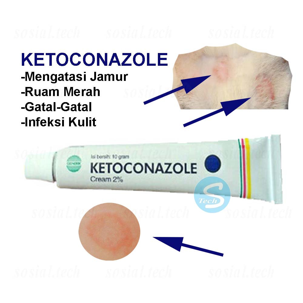 Jual Obat Jamur KETOCONAZOLE Ampuh / Salep Scabies / Ruam Merah Gatal ...