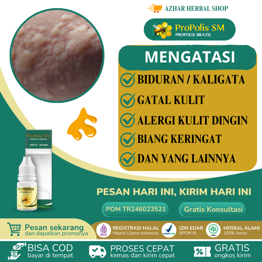 Jual Propolis - Obat Biduran Kaligata Alergi Gatal Kulit Dingin Biang ...