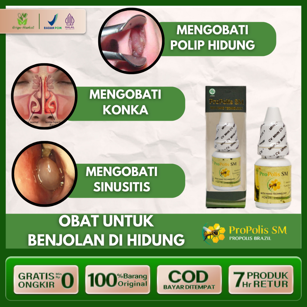 Jual Obat Benjolan di Dalam Hidung Pembesaran Konka Obat Polip Hidung Kronis Sinusitis | Shopee ...