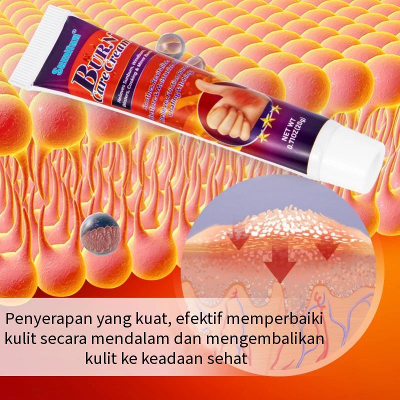 Jual Salep luka bakar Penghilang bekas luka bakar Obat luka bakar ...