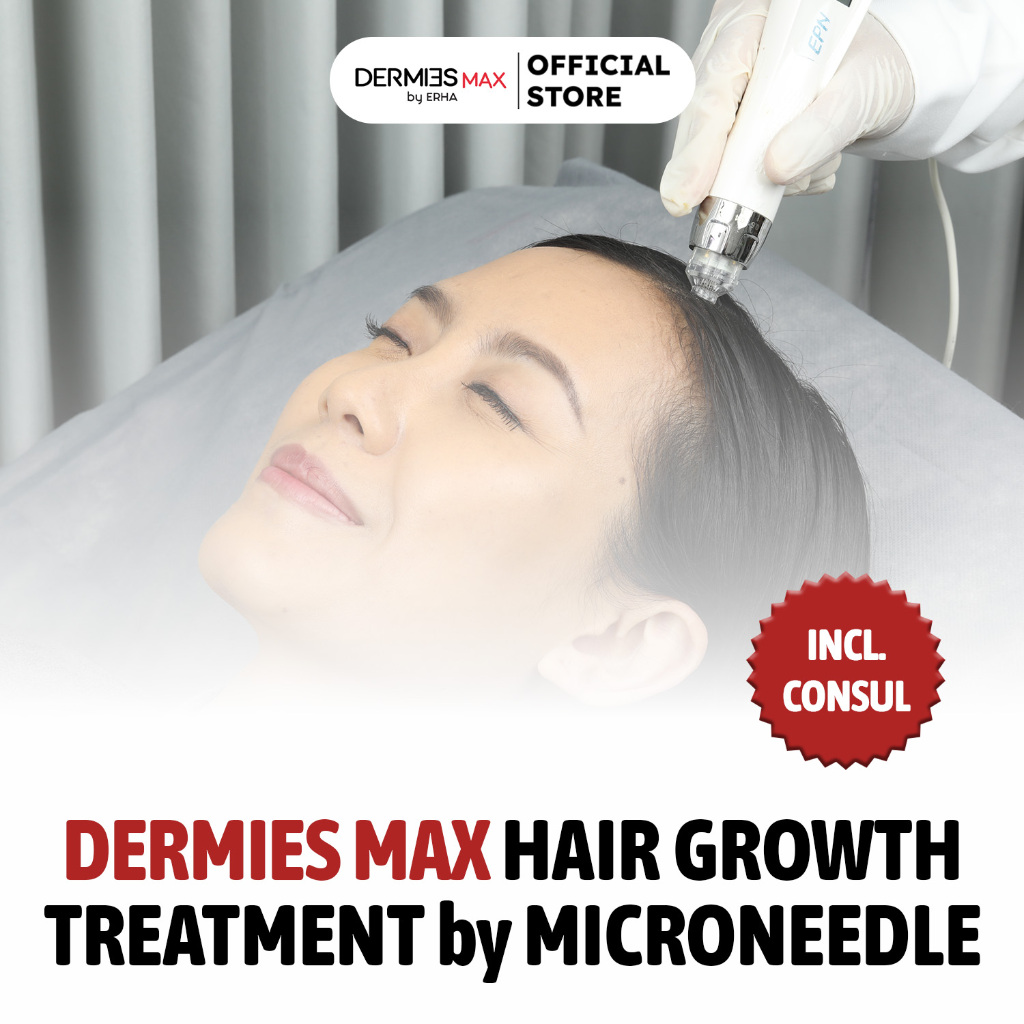 Jual Dermies Max Hair Growth Treatment By Microneedle | Shopee Indonesia
