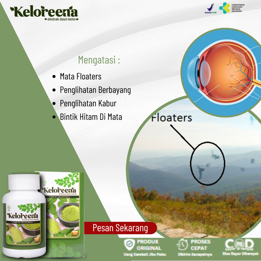 Jual Obat Mata Floaters, Obat Penglihatan Berbayang, Obat Bintik ...