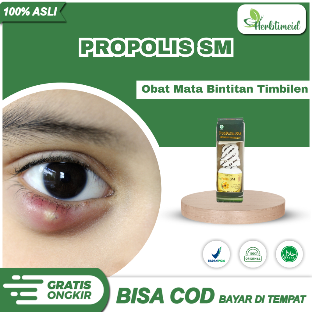Jual Propolis Sm Obat Mata Bintitan Timbilen Benjolan di Kelopak Mata ...