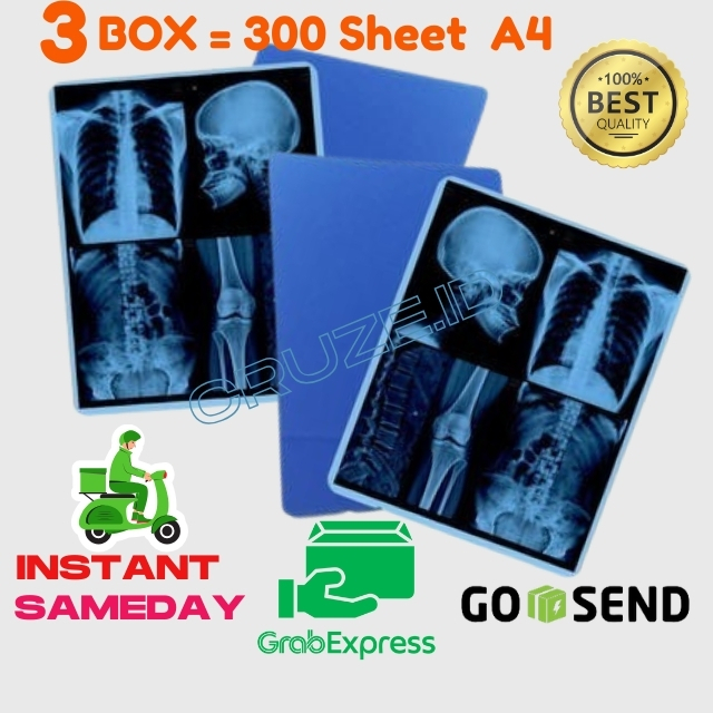 Jual Medical Dry Film Digital Radiology DR CR Rontgen X-Ray Inkjet ...