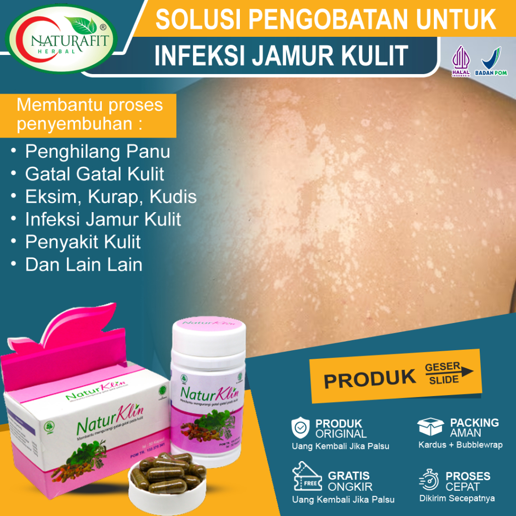 Jual Obat Panu Paling Ampuh Alergi Kulit Gatal Kadas Kurap penghilang ...