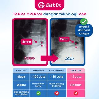 Jual NECK TRACTION DEVICE Penyangga Leher DISK DR SPIN UP CS500 G2- ALAT TERAPI NYERI LEHER ...