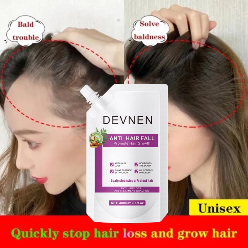 Jual DEVNEN Shampo Rambut Rontok Oil Control Anti-Dandruff Anti Hair ...