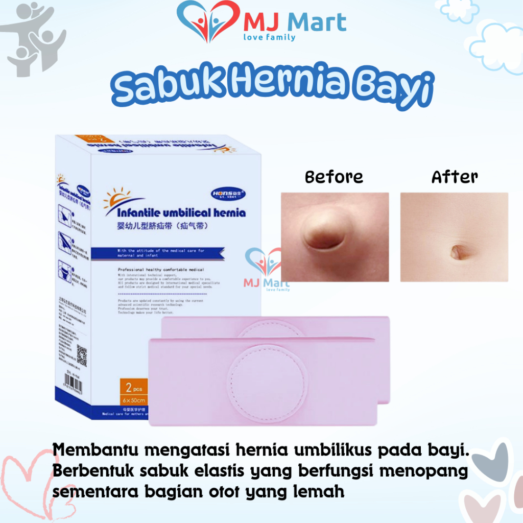 Jual Baby Infantile Umbilical Hernia Belt / Sabuk Hernia Bayi Dan Anak ...