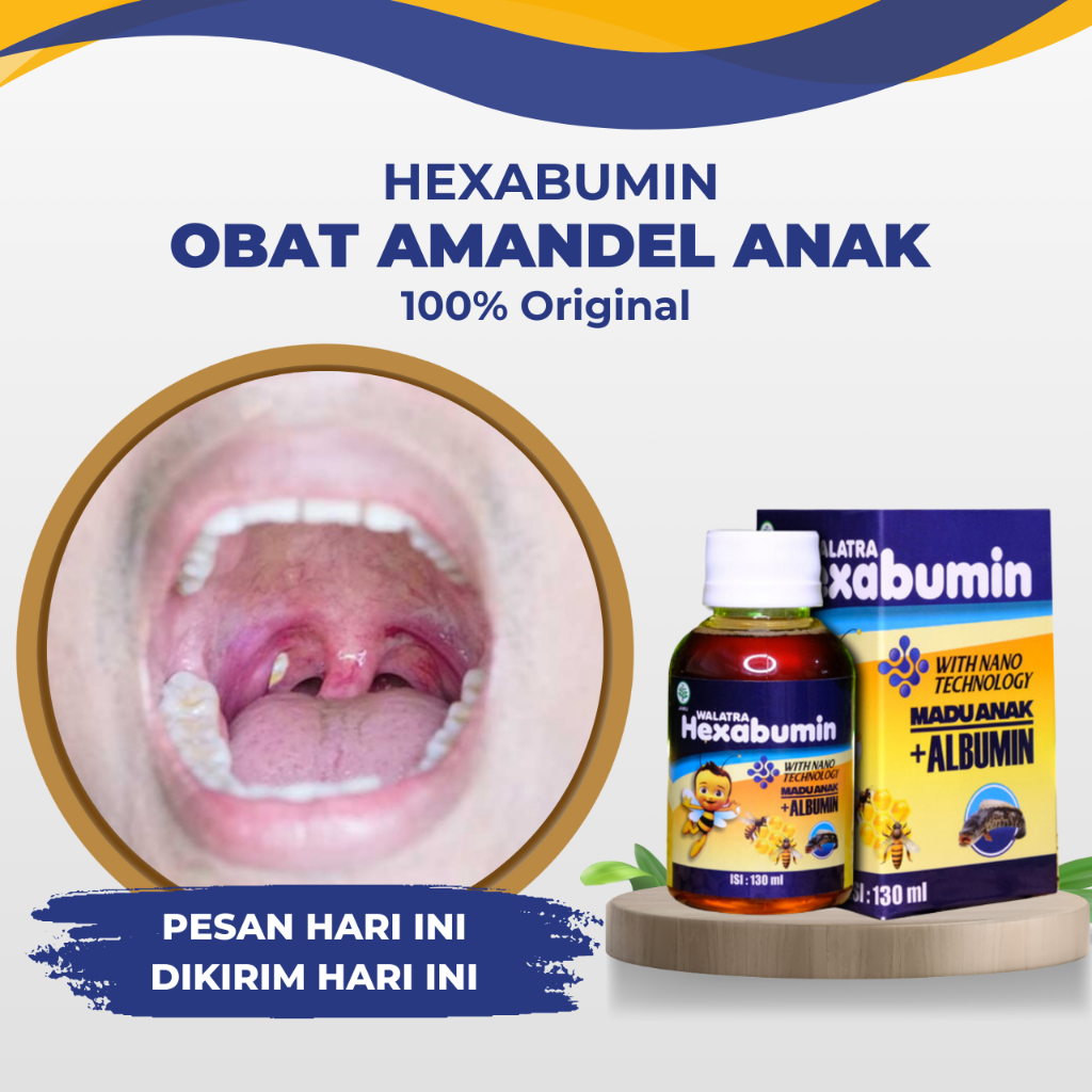 Jual Obat Amandel Anak Sakit Tenggorokan Dan Sulit Menelan Radang ...