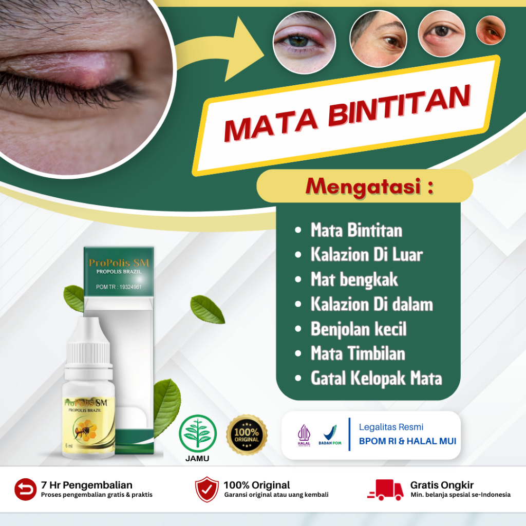 Jual Obat Mata Bintitan Kalazion Benjolan Di Kelopak mata Herbal ...