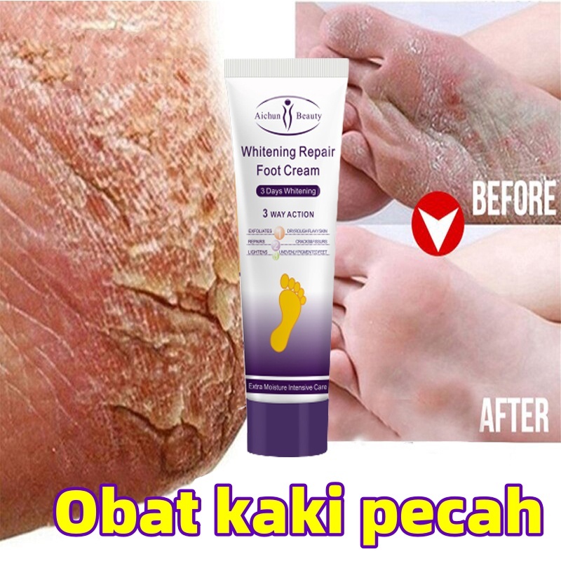 Jual Foot cream 100g Obat kaki pecah Krim Kaki Pecah Dan Kering ...