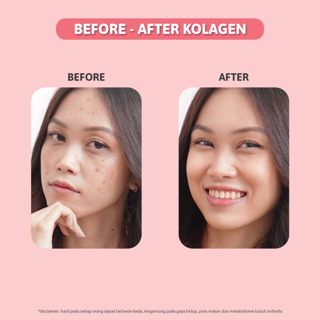 Jual [1 Tube - 10 Tablet] COOLVITA ORIGINAL Collagen Effervescent ...