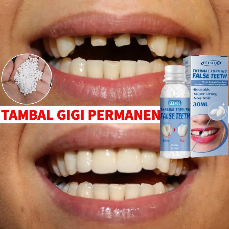 Jual Gigi Palsu Penambal gigi berlubang Tambal gigi permanen Temptooth ...