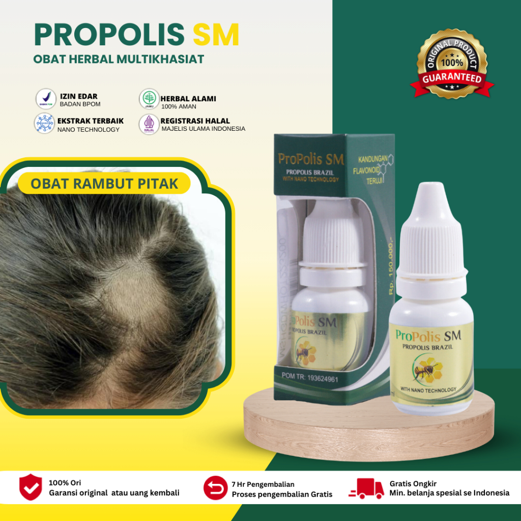 Jual Obat Oles Jamur Di Kulit Kepala, Kepala Berjamur, Gatal, Kulit Autoimun, Obat Botak Koin ...