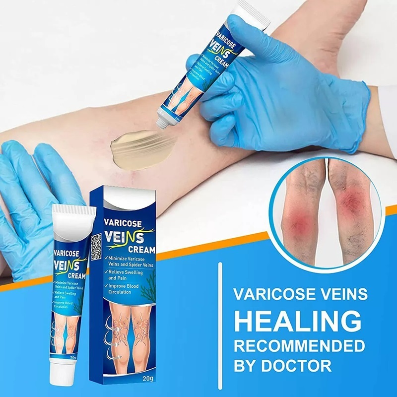 Jual cream varises original Varicose Veins Cream Obat Varises Paling ...