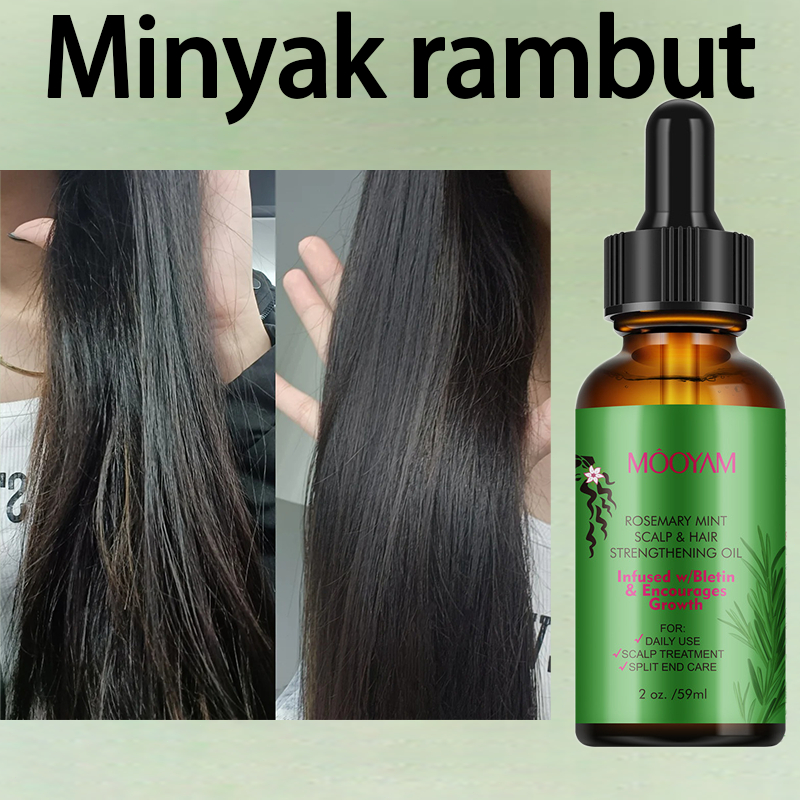 Jual Minyak Esensial Rosemary Rambut Halus Minyak Esensial untuk ...