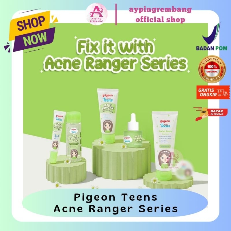 Jual Pigeon Teens Acne Ranger Series Lengkap | Shopee Indonesia