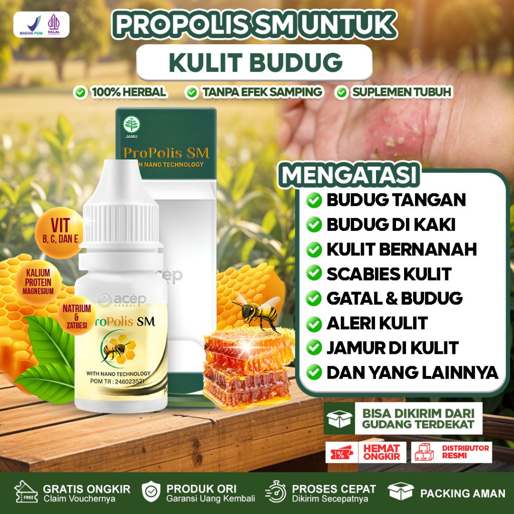 Jual Obat Budug Kulit Gatal Seluruh Badan Tangan Dan Kaki Bernanah ...