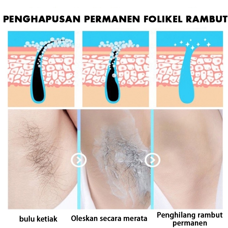 Jual Perontok bulu permanen penghilang bulu ketiak semprotan penghilang ...