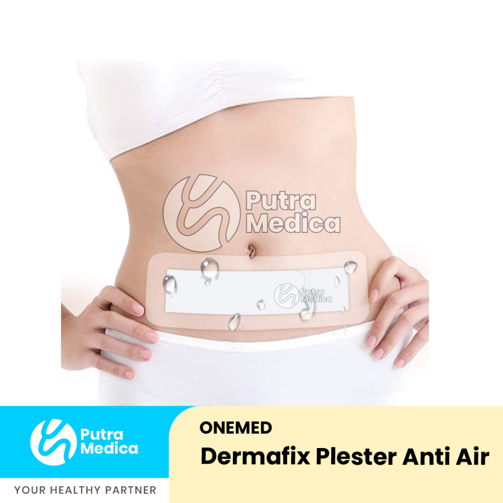 Jual Onemed Dermafix T Plester Anti Air 10x25cm - 1 Pc / Plaster ...
