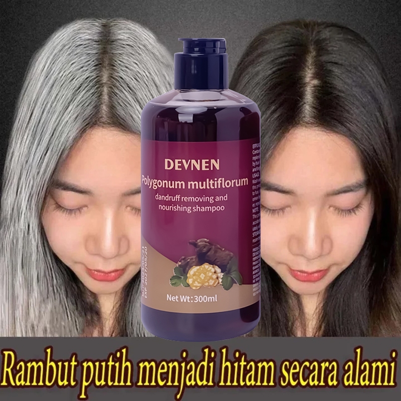 Jual Shampo poligonum multiflorum 300ml Herbal Perawatan rambut shampo ...