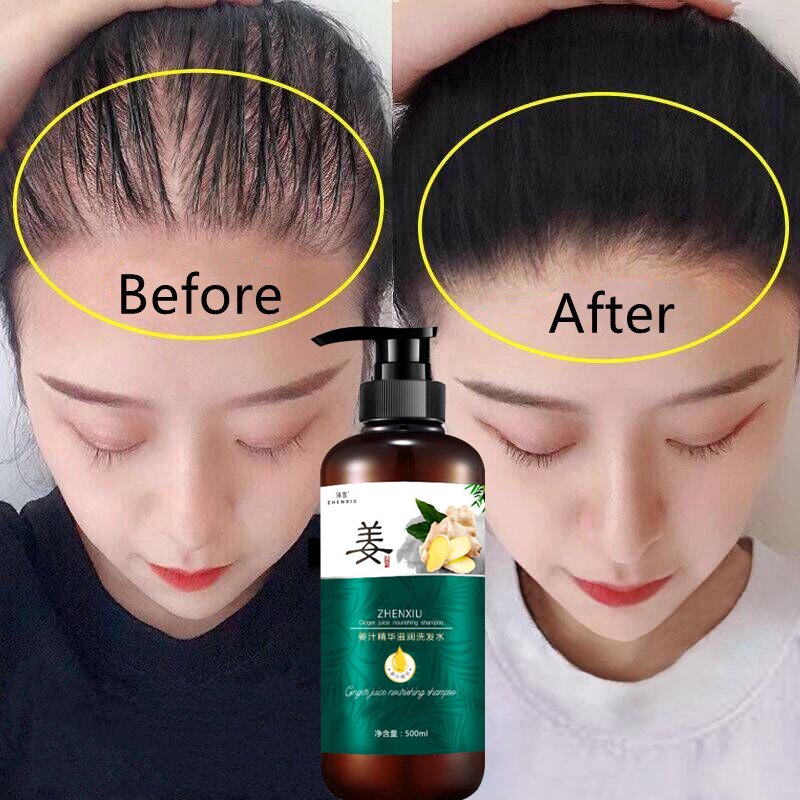 Jual Sampo Penumbuh Rambut Cepat Shampo Rambut Rontok Shampo Jahe Hair ...