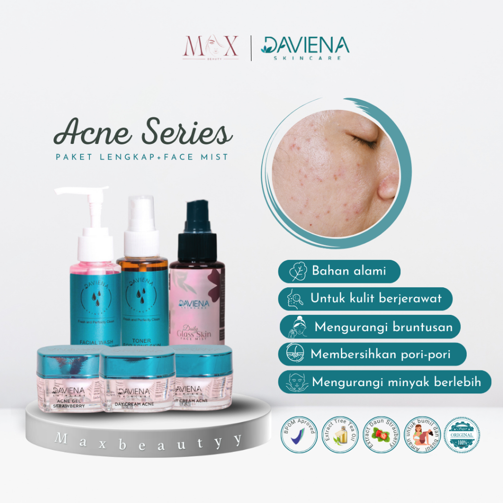Jual Paket Bundling Daviena Acne Series + Facemist | Shopee Indonesia