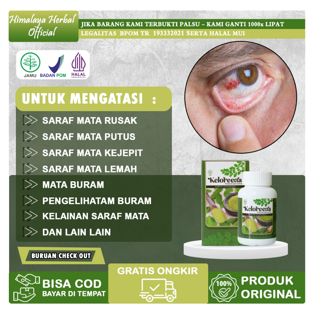 Jual Obat Saraf Mata Rusak Kejepit Mata Lemah Mata Berlemak Parah ...