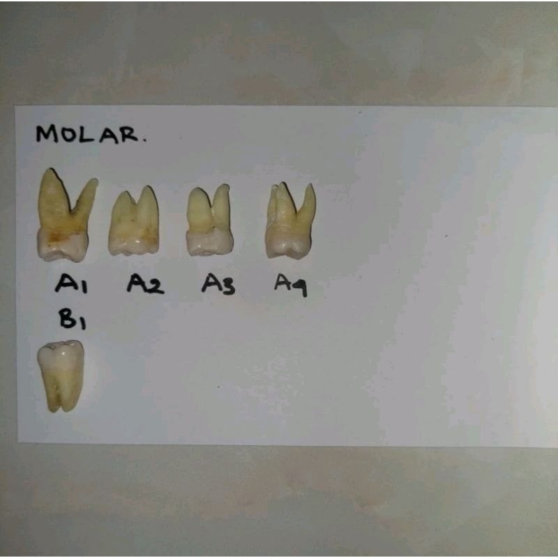 Jual Gigi Molar Geraham Permanen Rahang Atas Bawah Asli Praktikum FKG ...