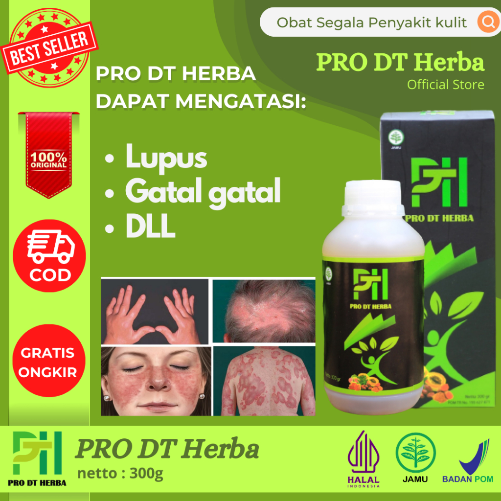 Jual Obat Lupus Autoimun Psoriasis Kulit Ruam Bersisik Eksim Dermatitis ...