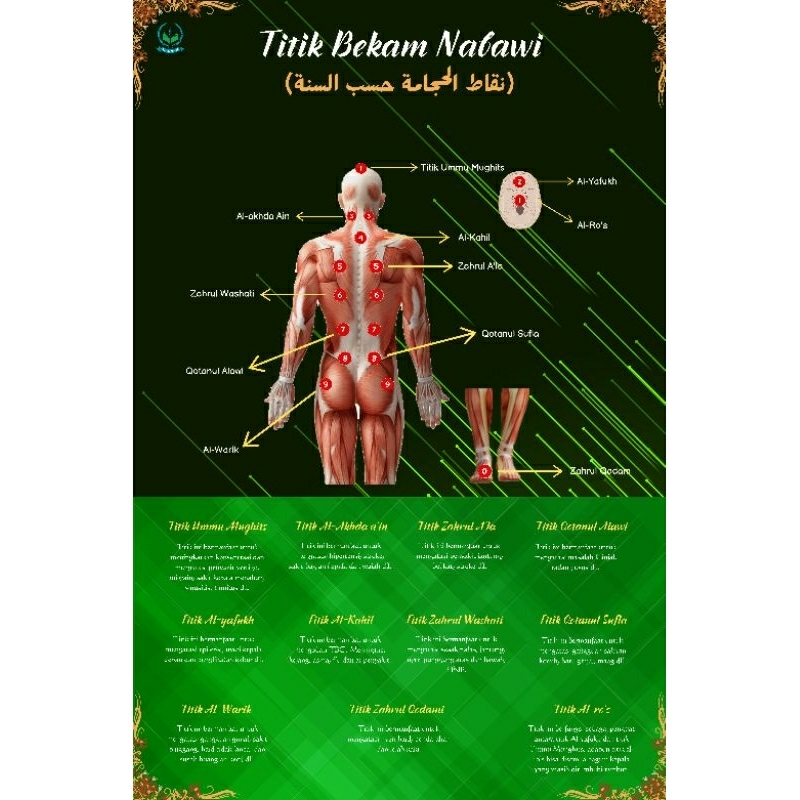 Jual Poster Titik Bekam/Hijamah Nabawi | Shopee Indonesia