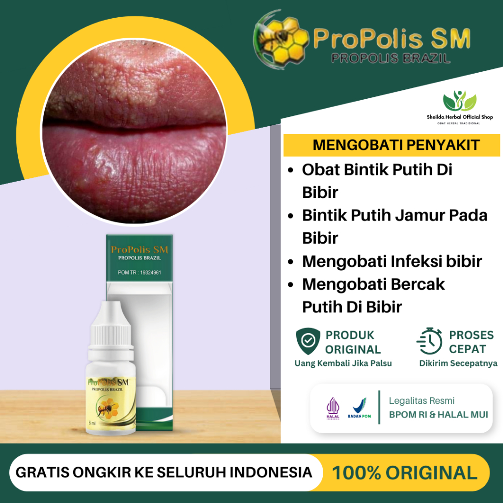 Jual Obat Bintik Putih Di Bibir, Penghilang Bercak Putih Di Bibir ...