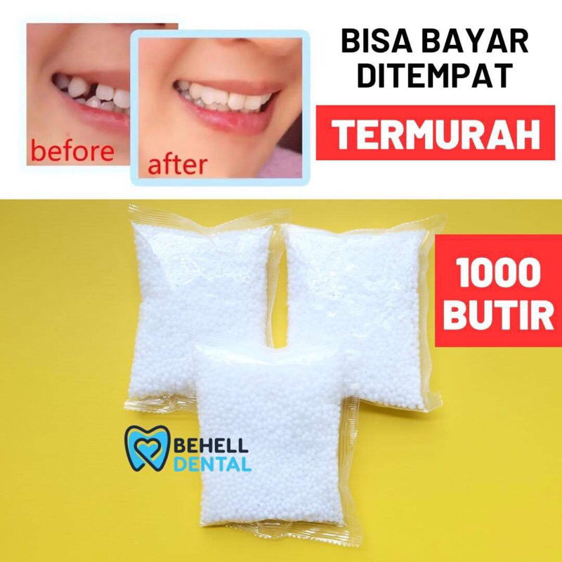 Jual GIGI PALSU SEMENTARA 1000 BUTIR / PENAMBAL GIGI PATAH RENGGANG ...