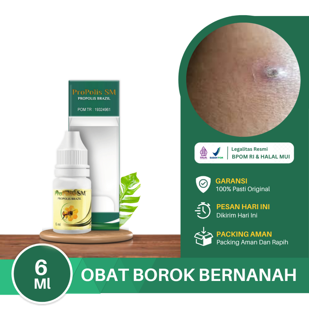 Jual Obat Borok Bernanah, Luka Infeksi Bernanah, Penghilang Bekas Borok ...