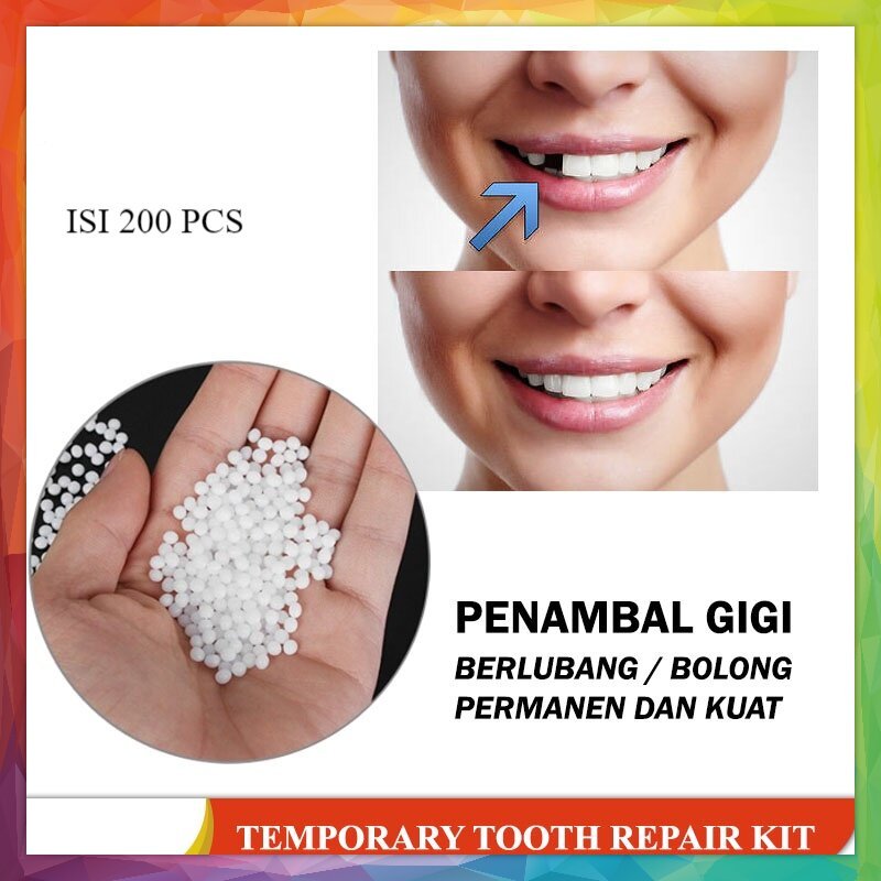 Jual GIGI PALSU SEMENTARA 200 BUTIR / PENAMBAL GIGI PATAH RENGGANG ...