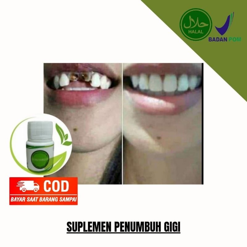 Jual SUPLEMEN PENUMBUH GIGI ORIGINAL MENUMBUHKAN GIGI BERLUBANG, GIGI ...